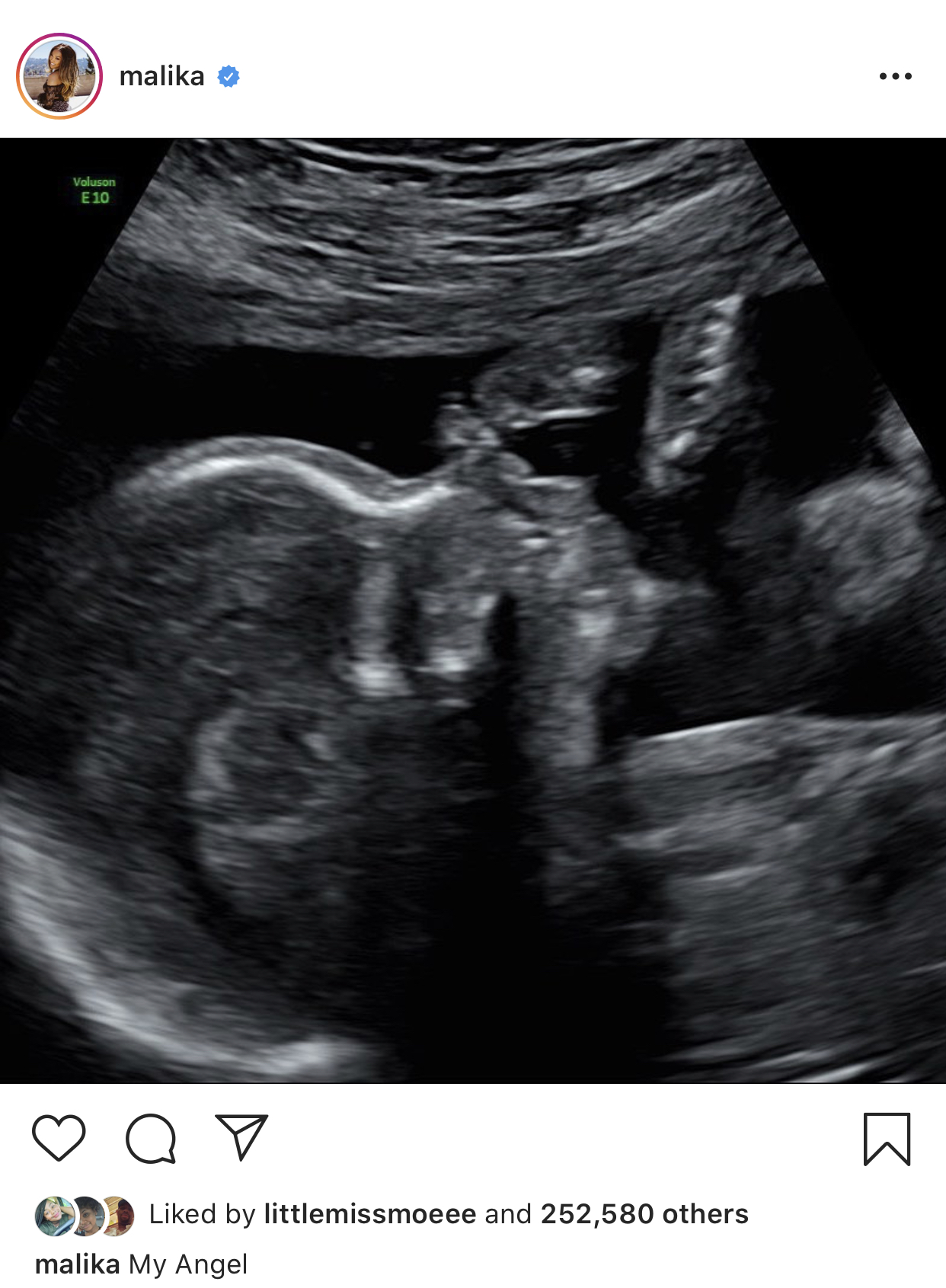 Malika Haqq Shares 1st Sonogram [Photo] - theJasmineBRAND