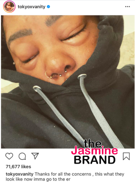 Yung Berg Shows His Face After Appearing To Suffer Severe Allergic ...
