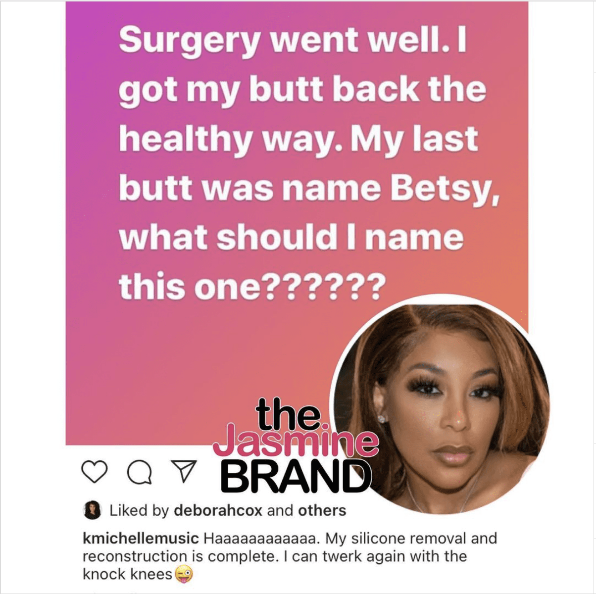 K. Michelle Celebrates Successful Butt Reconstructive Surgery: I Can ...
