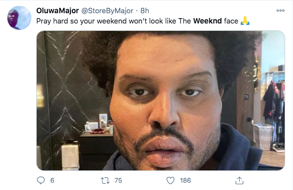 The Weeknd’s Dramatic Plastic Surgery-Enhanced Face For 'Save Your ...