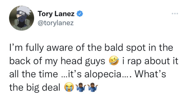 Tory Lanez Discusses His Hair Loss, Says He Has Alopecia After Jokes ...