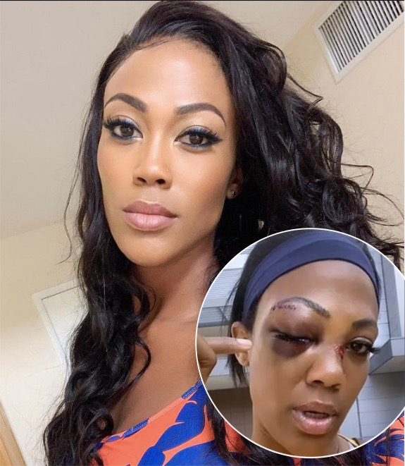 Update: Los Angeles Man Charged with Felony After Allegedly Assaulting ...