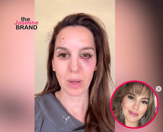 Actress Christy Carlson Romano Says She's 'Grateful To Be Alive' After ...